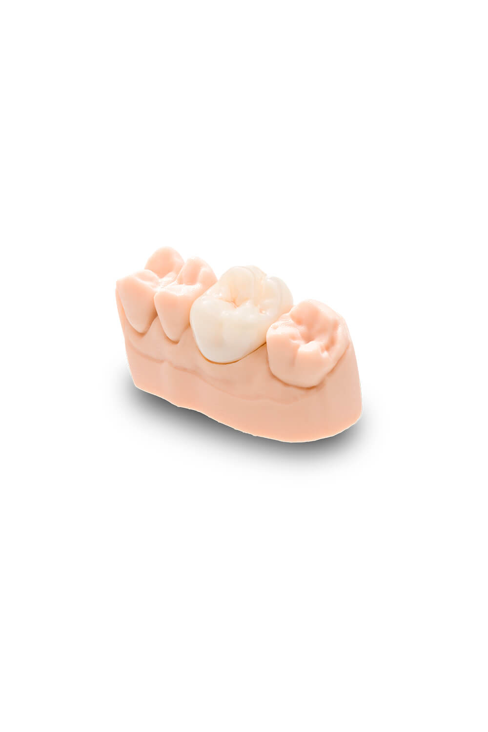 Resina Saremco® Crowntec - Bionexum Dental Solutions
